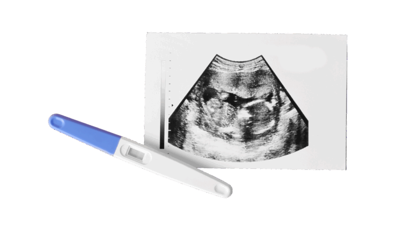 Pregnancy Scans Near Kingston Upon Thames | Peek a Baby