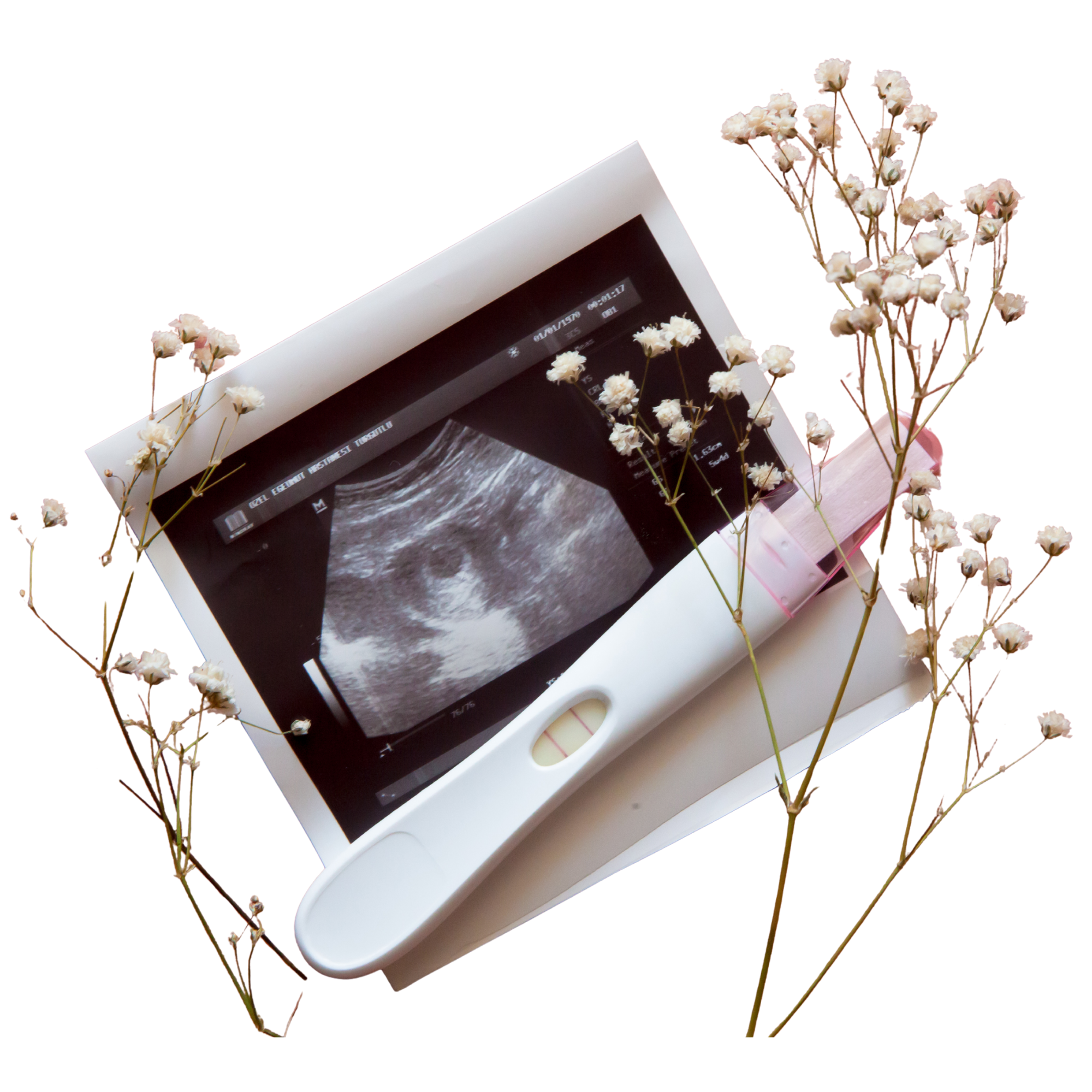 Same Day Pregnancy Scan in Birmingham | Peek a Baby